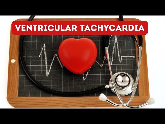 Ventricular Tachycardia: Understanding a Dan... | Open Video