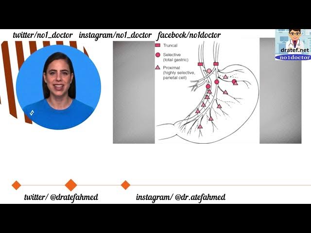 Vagotomy /Types/Indications/Surgery/Laparos... | Humix Video