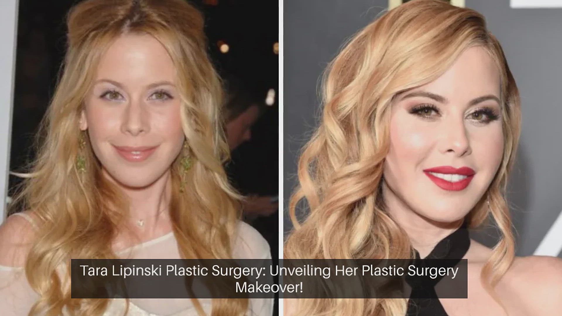 Alexis Bledel Nose Job Before And After